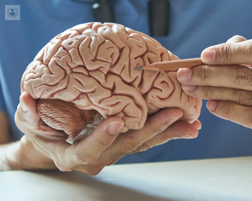 Cuándo ir al neurólogo | Top Doctors