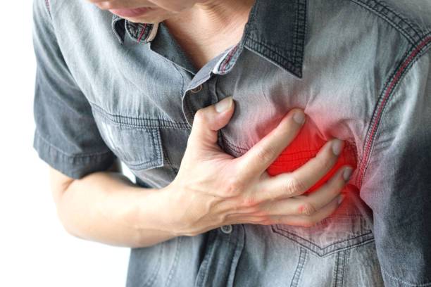 Infartos ¿cuáles Son Los Principales Factores De Riesgo Top Doctors